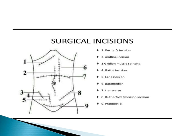 Abdominal incisions