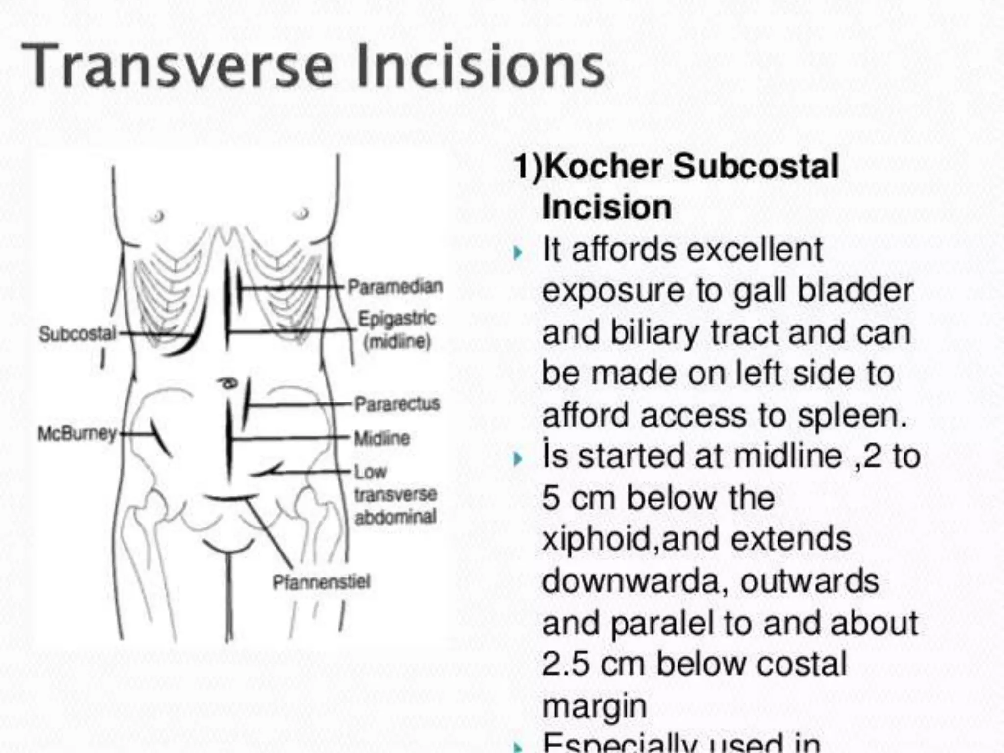 Abdominal incisions | PPTX