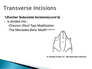 Abdominal incisions | PPTX