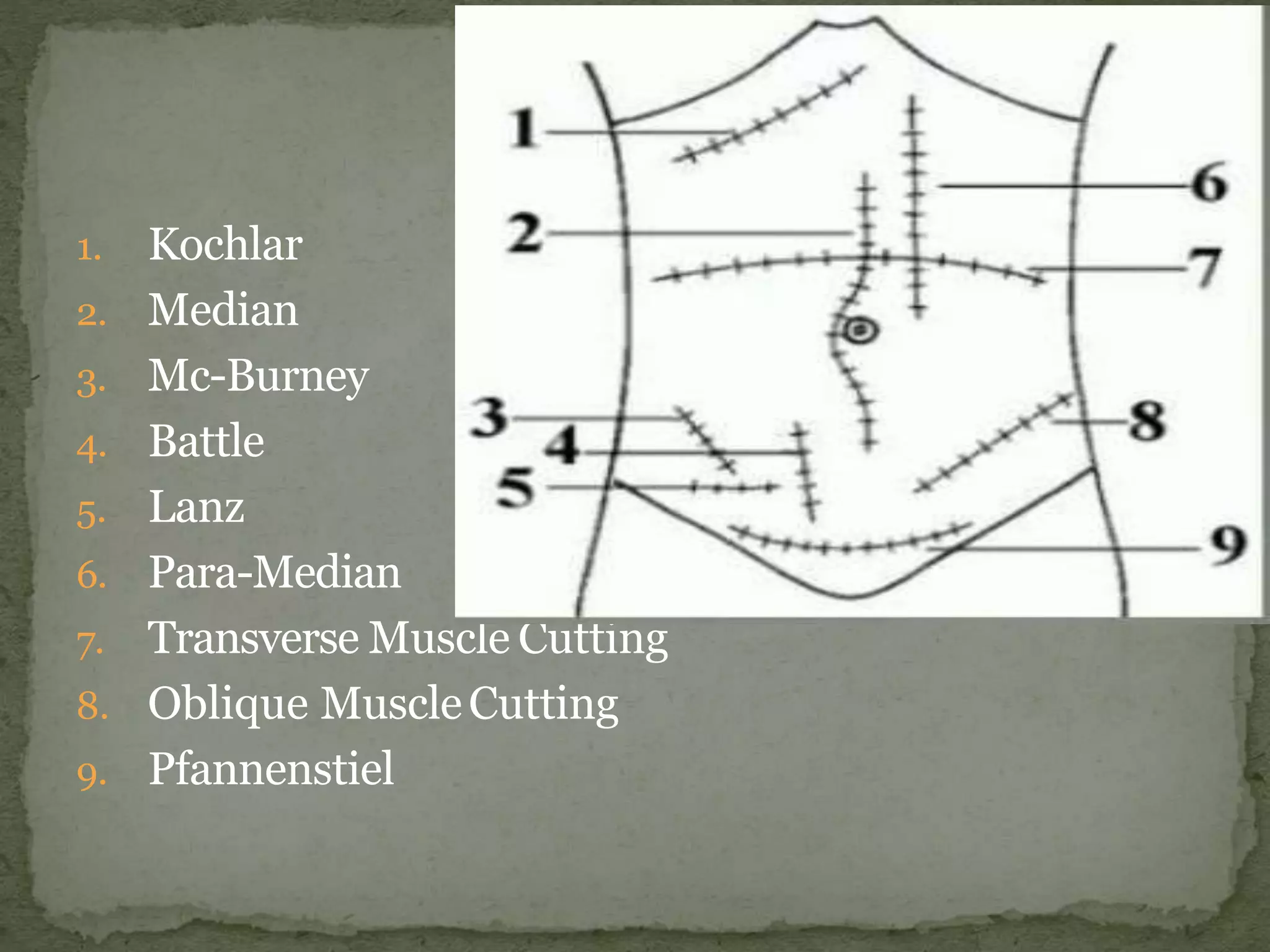 Abdominal incisions | PPTX