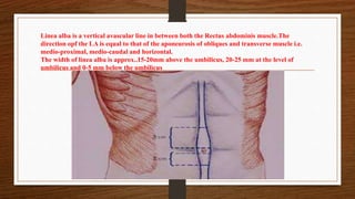 Abdominal incisions | PPTX
