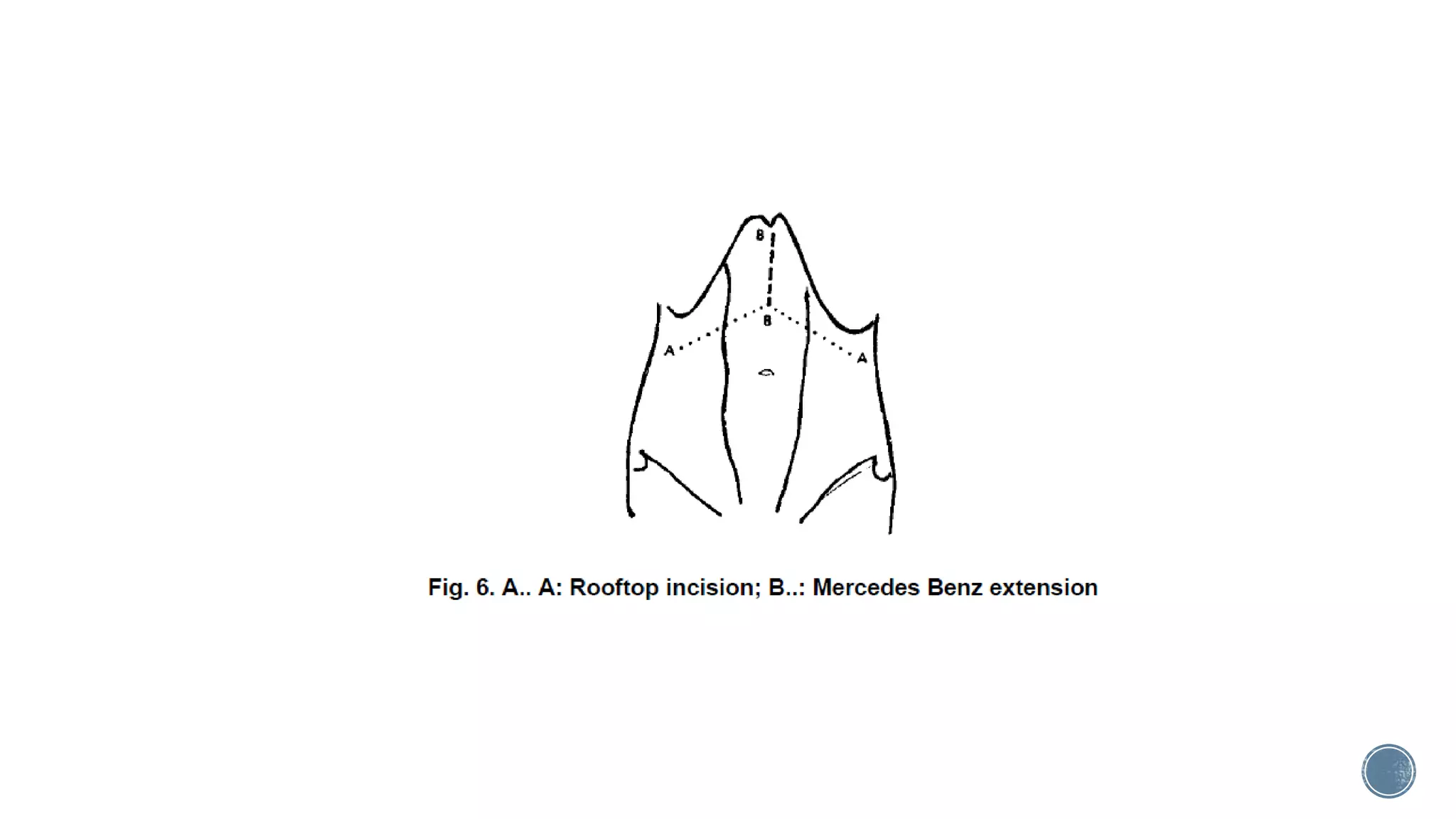 Abdominal Incisions.pptx