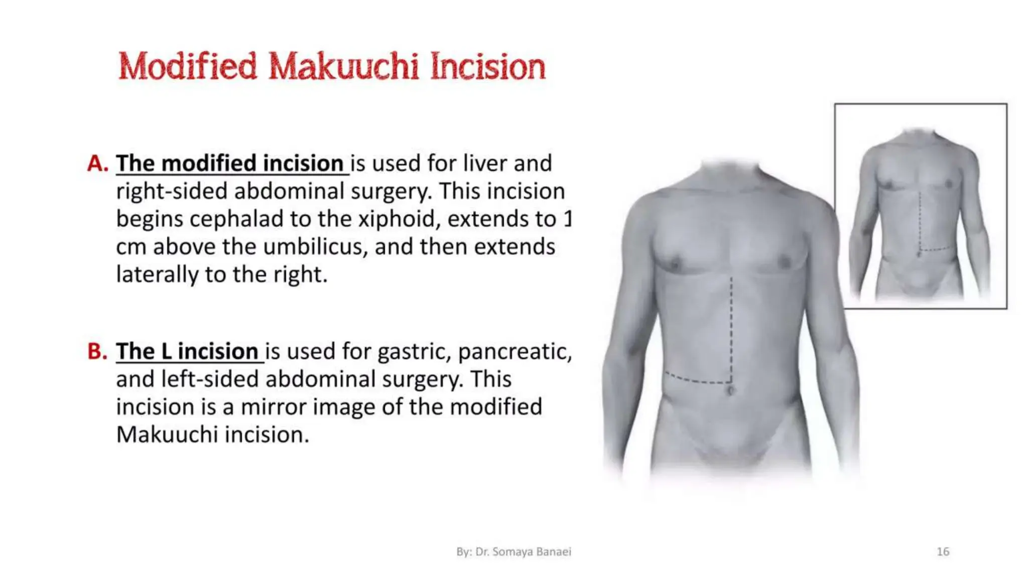Abdominal Incisions for medical students | PPT | Free Download