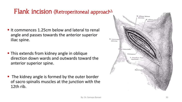 Abdominal Incisions for medical students | PPTX