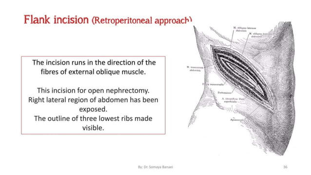 Abdominal Incisions for medical students | PPT
