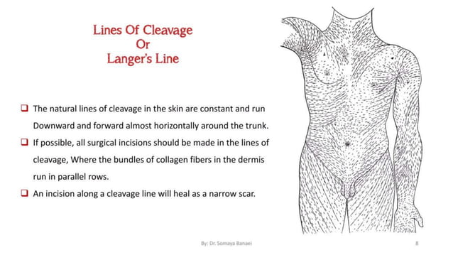 Abdominal Incisions for medical students | PPT