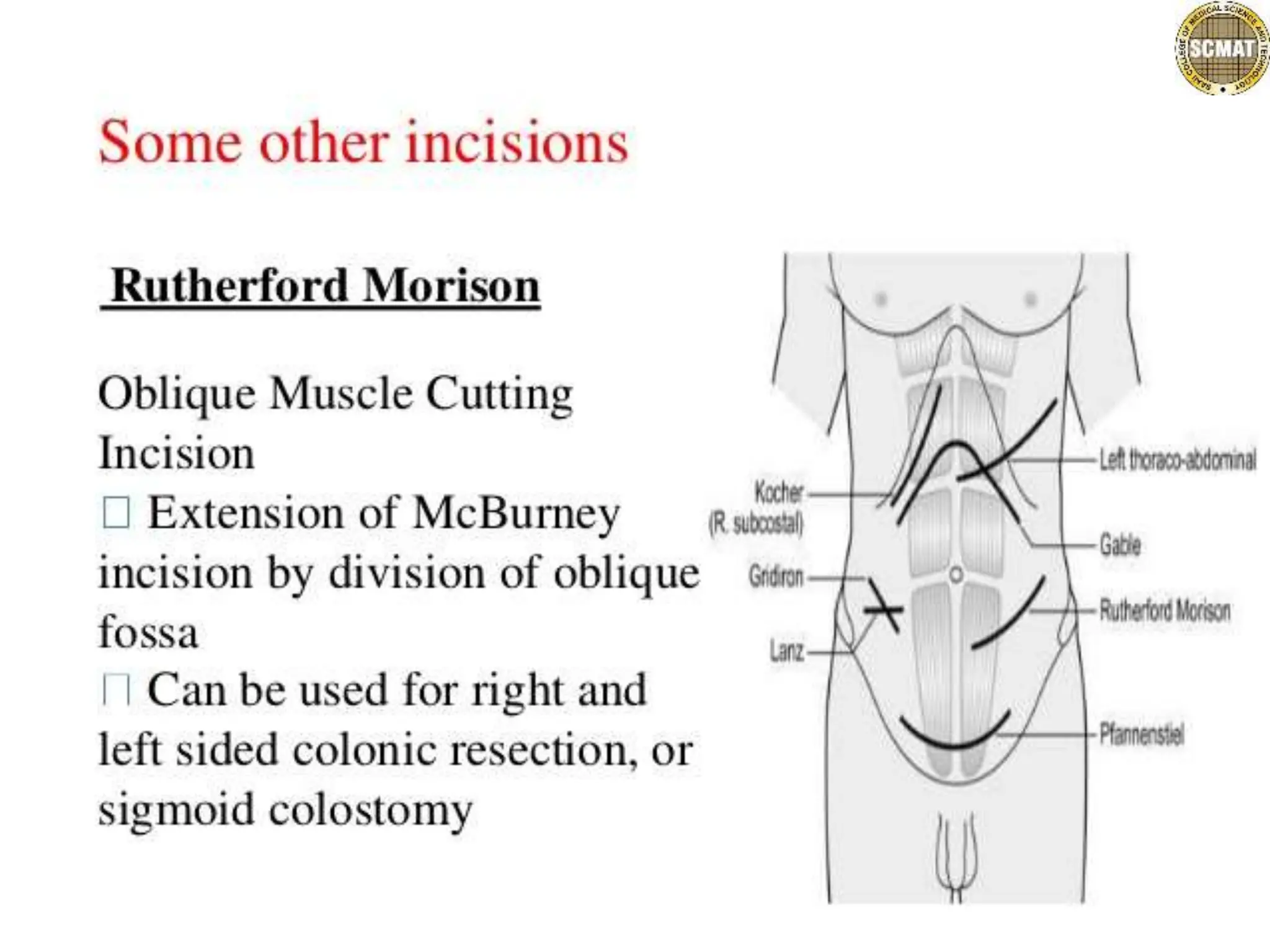 abdominal incisions.pptx