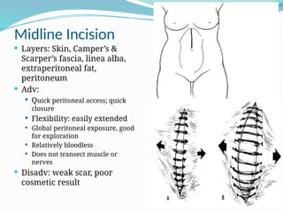 ABDOMINAL INCISIONS- DAVID surgical tutorial and lecture.pptx
