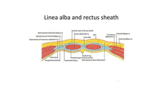 ABDOMINAL INCISIONS AND LAPAROTOMY-1.pptx
