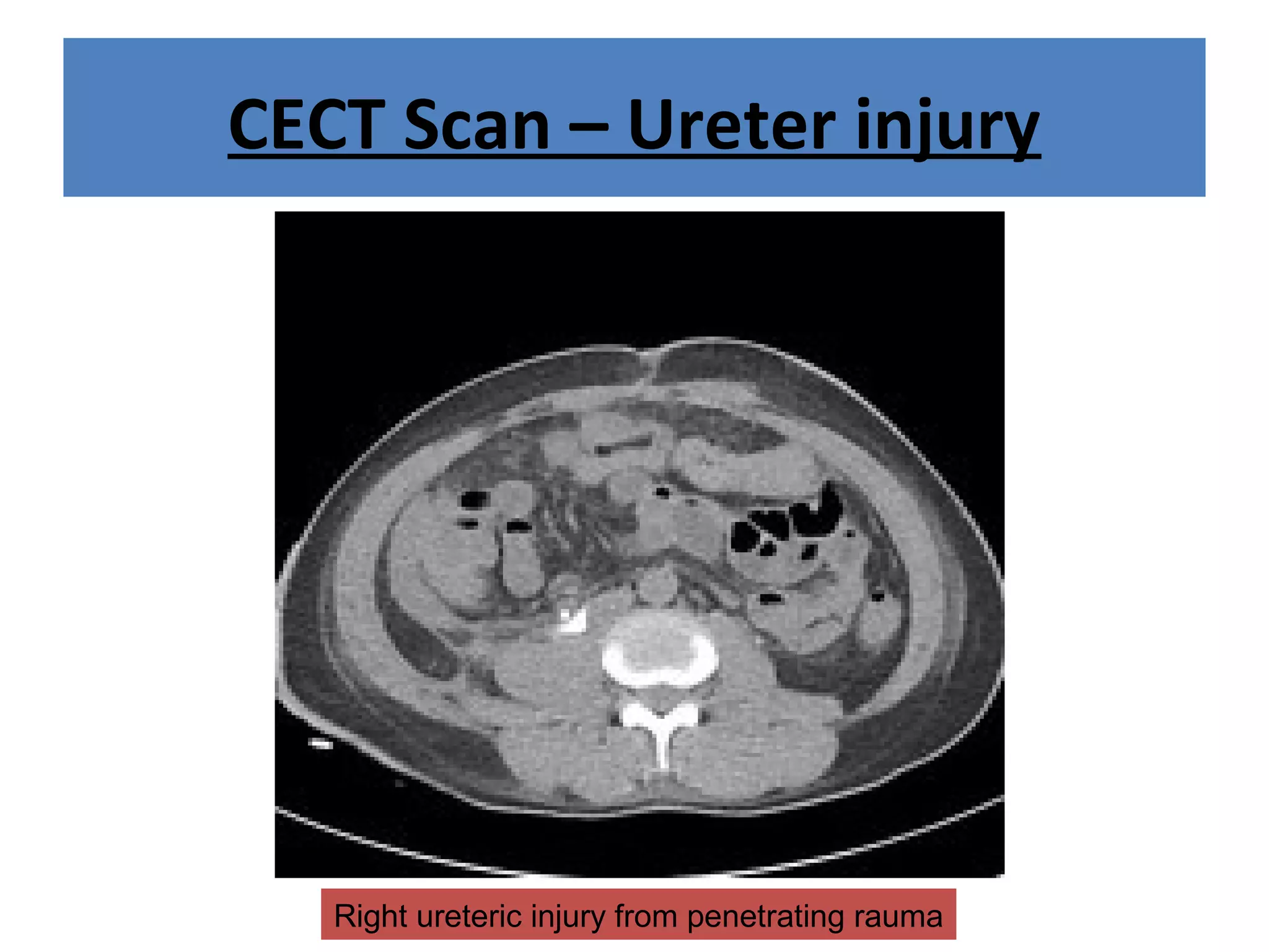 Abdominal injuries | PPT
