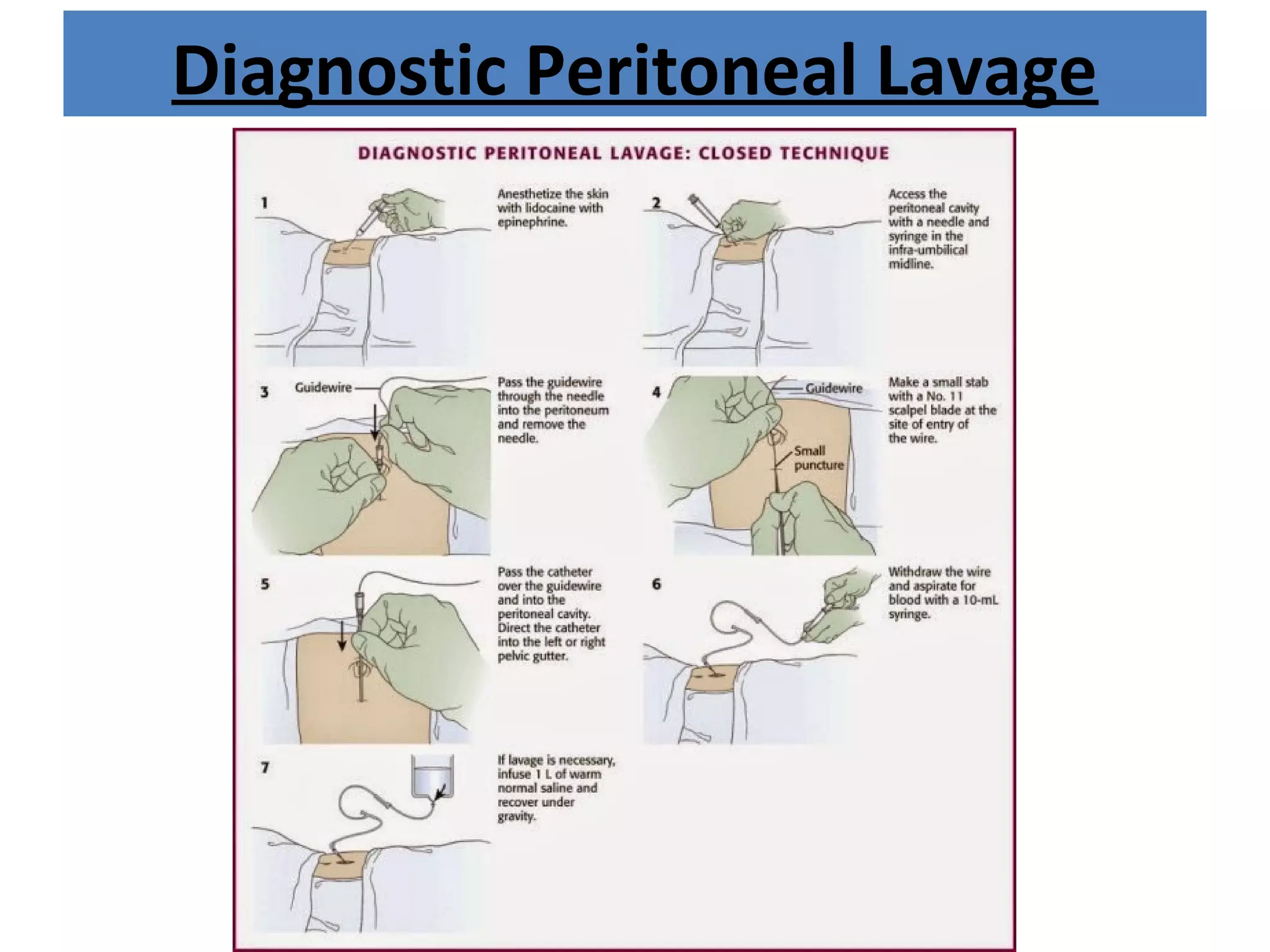 Abdominal injuries | PPT