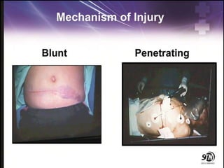ABDOMINAL INJURIES.ppt