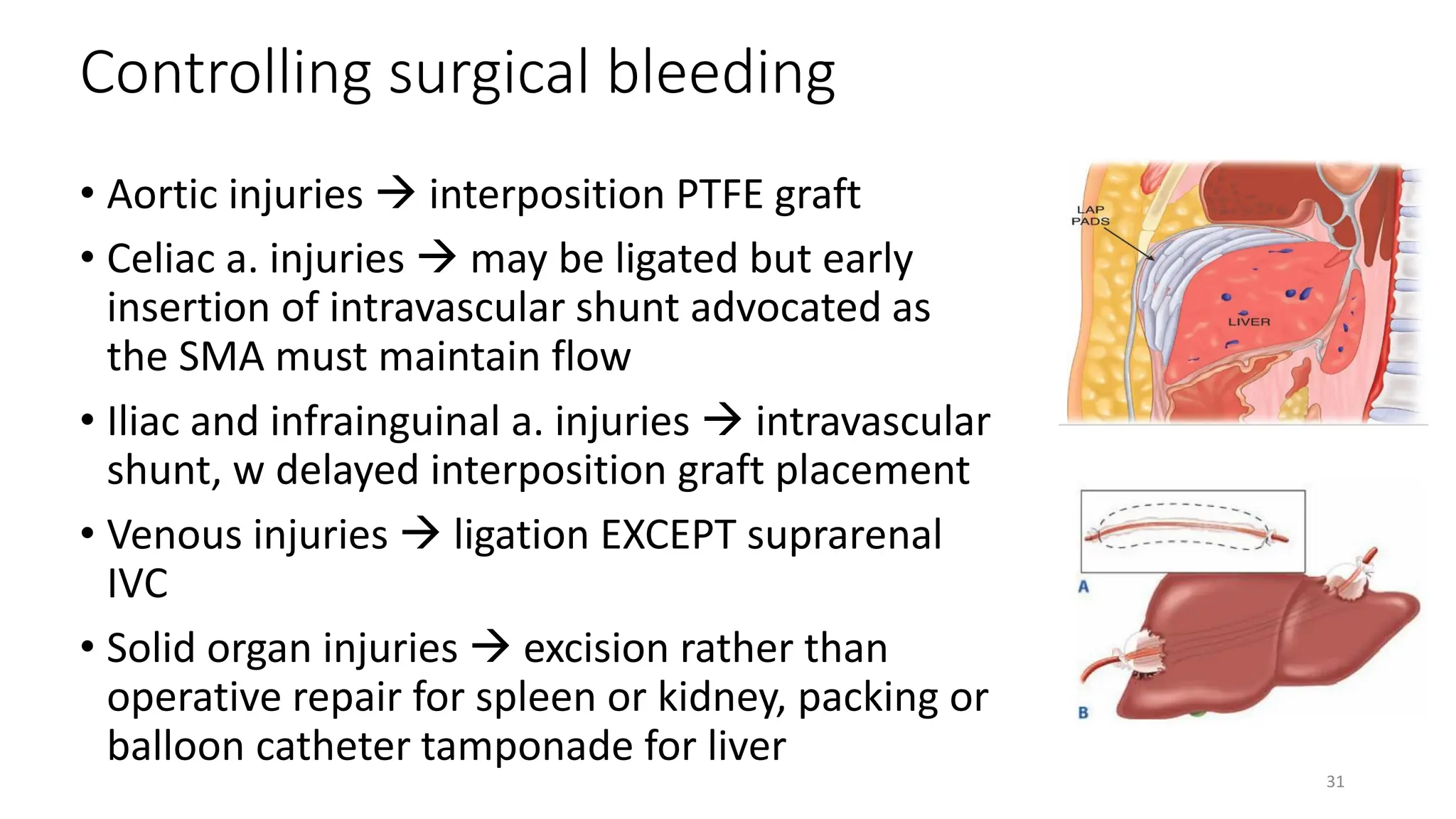 Abdominal injuries.pdf