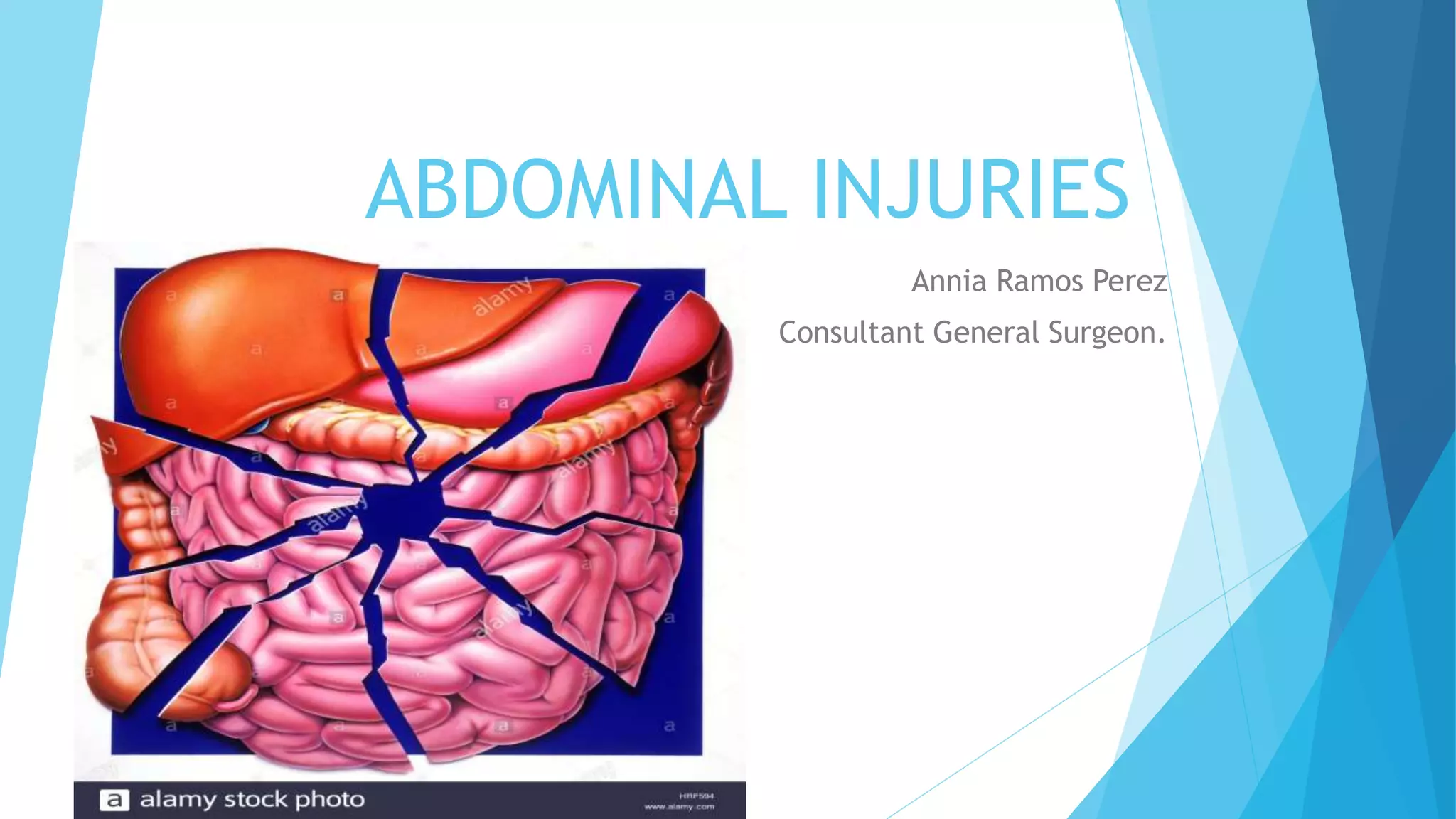 Abdominal injuries, lecture | PPTX