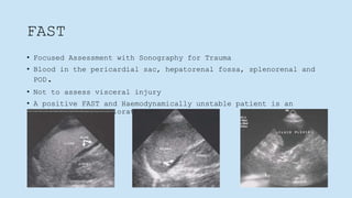 Abdominal Injuries Part 1.pptx