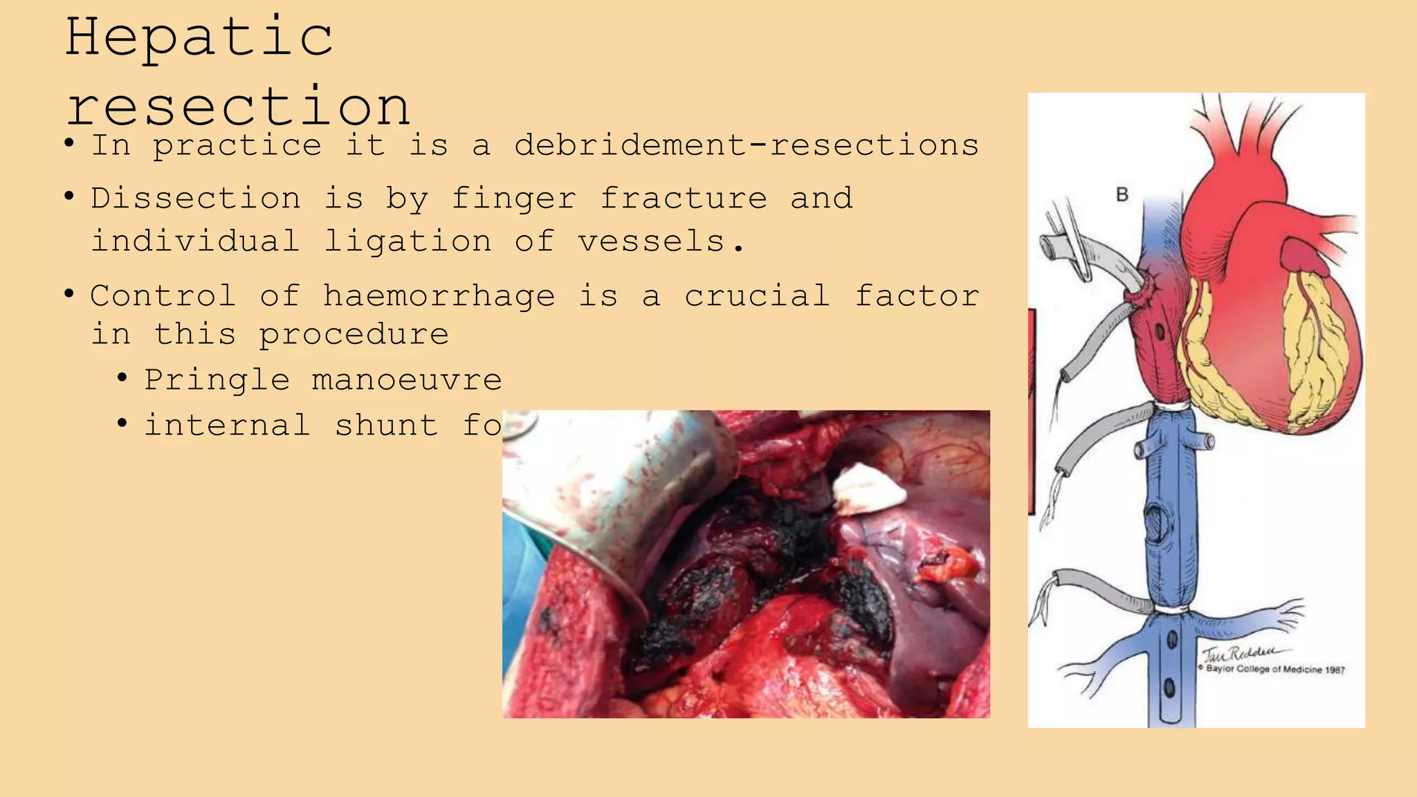 Abdominal Injuries Part 2.pptx