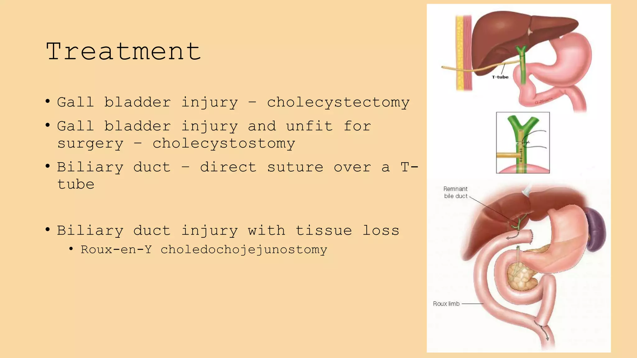 Abdominal Injuries Part 2.pptx