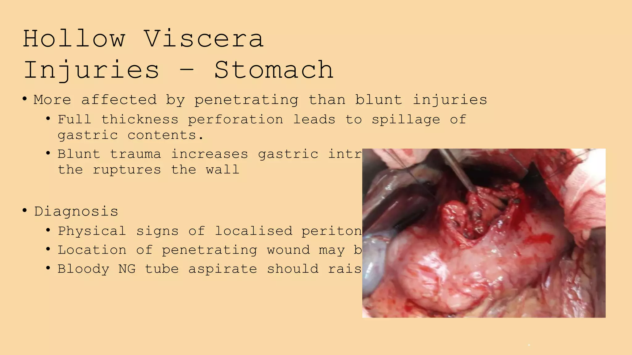 Abdominal Injuries Part 2.pptx