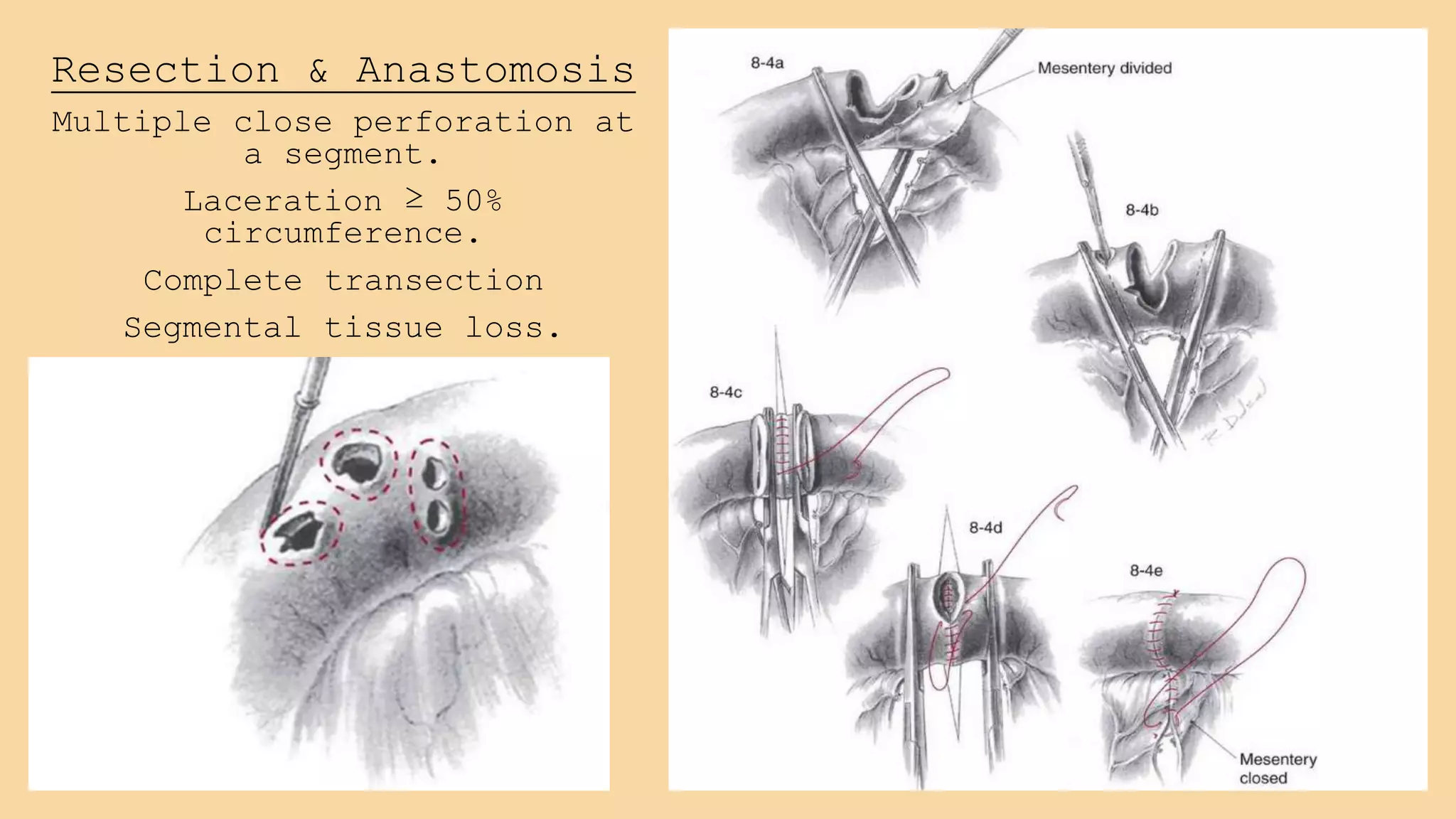 Abdominal Injuries Part 2.pptx