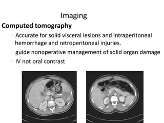 ABDOMINAL INJURIES And the management of | PPTX