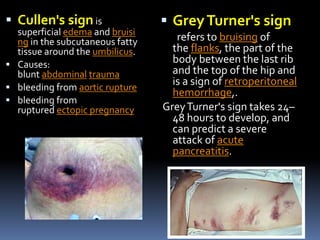Abdominal injury a forensic view | PPT