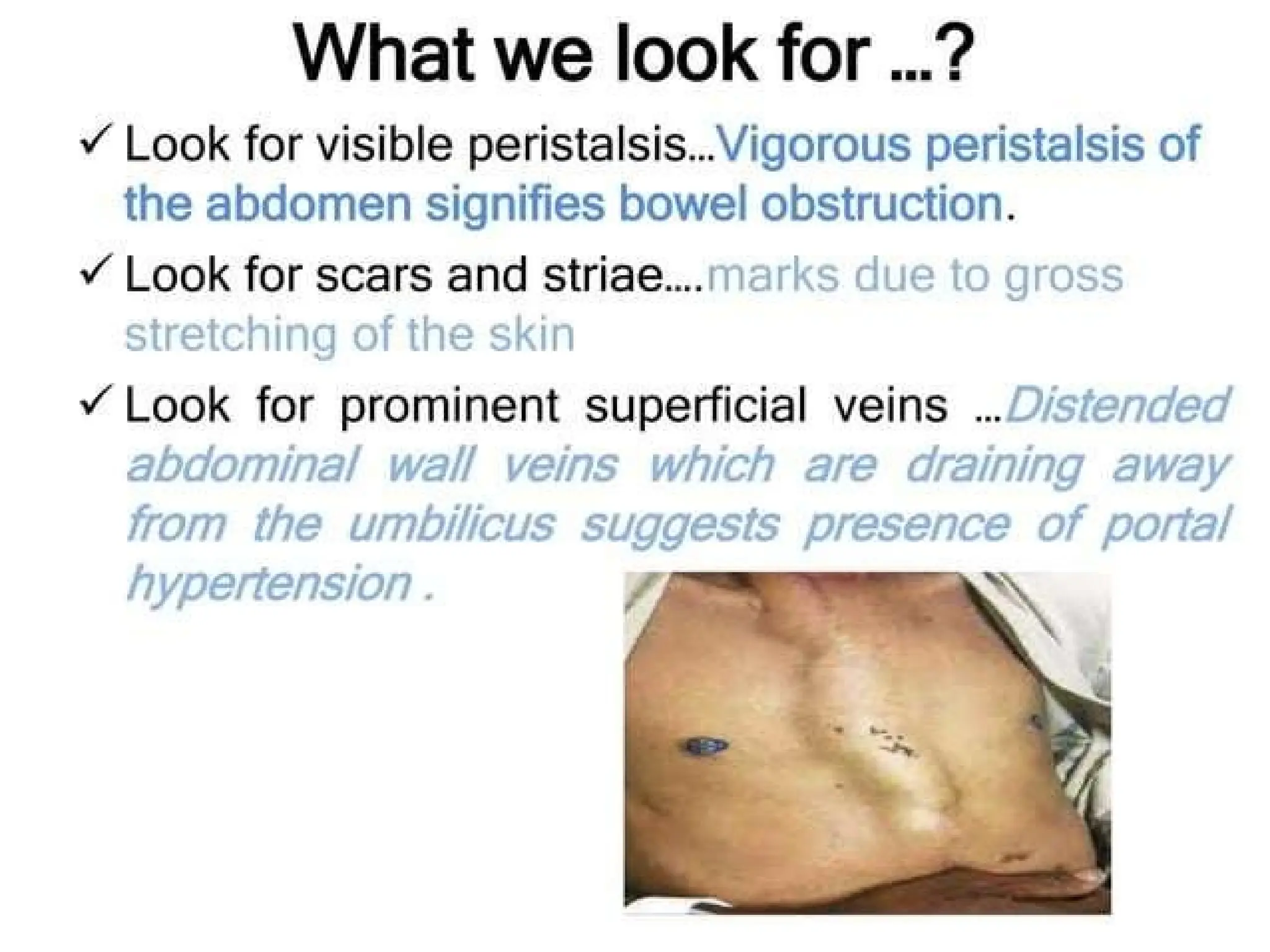 Surgery case presentation Abdominal Lump.pptx