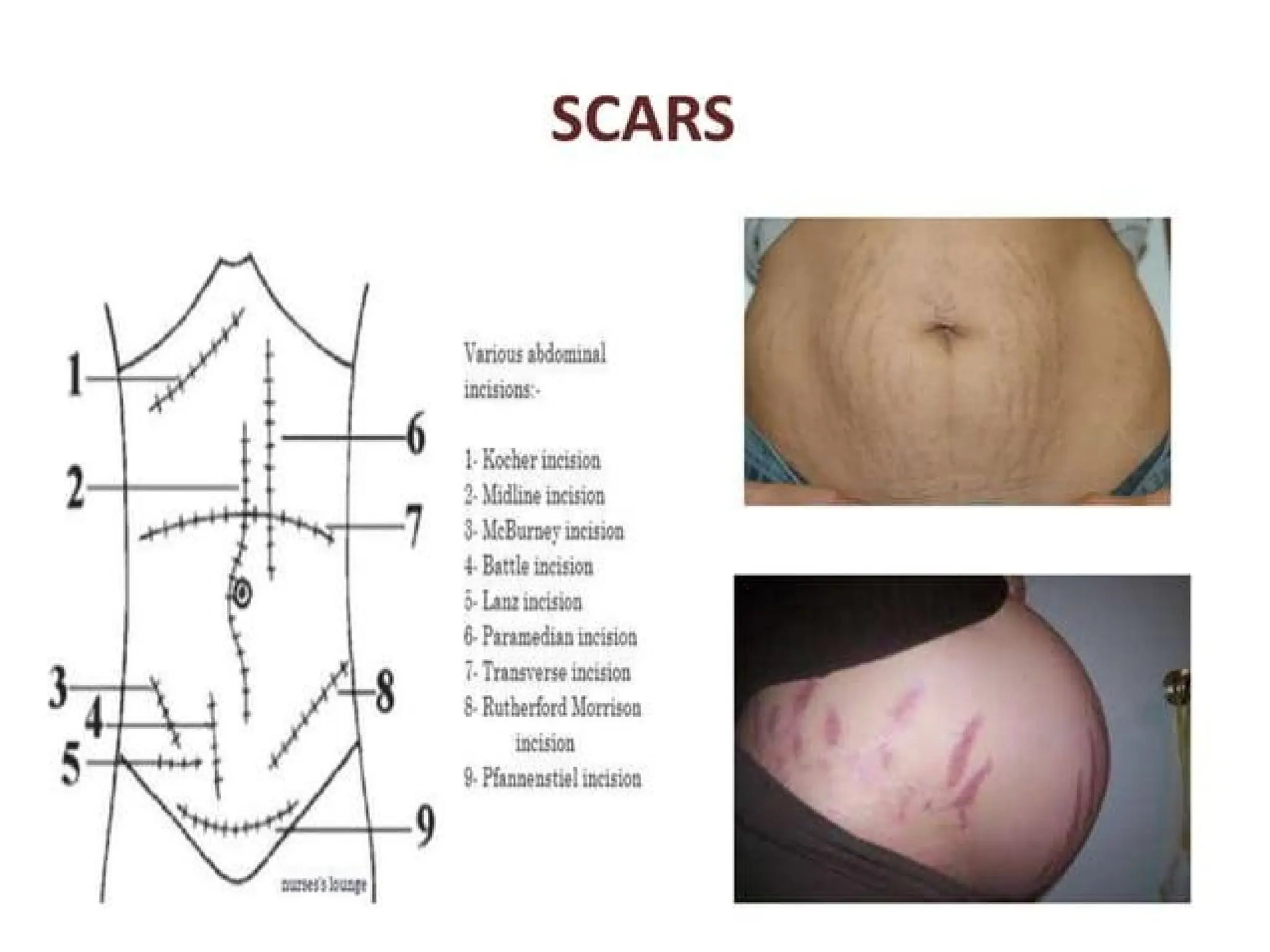 Surgery case presentation Abdominal Lump.pptx