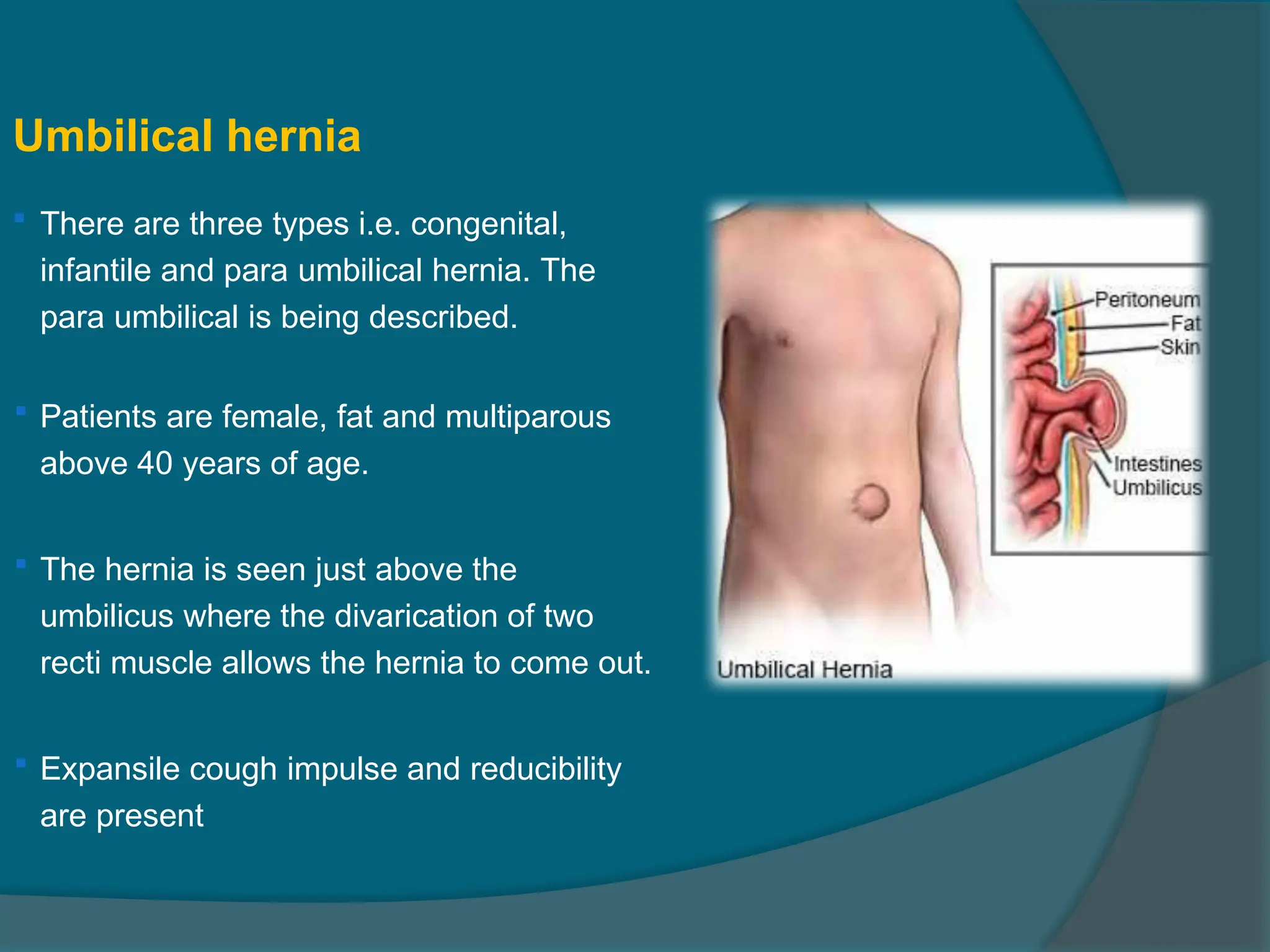 Abdominal lump examination for general surgery students .pptx