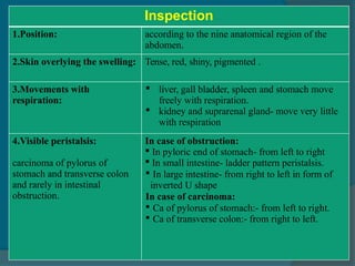 Abdominal lump examination for general surgery students .pptx