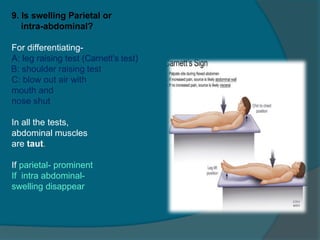 Abdominal lump examination for general surgery students .pptx