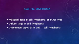 Abdominal lymphoma updated (1). classification | PPTX