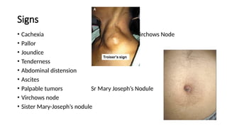 ABDOMINAL MALIGNANCIES power point...pptx