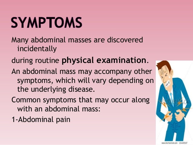 Abdominalmass 140808145556-phpapp01 (3)