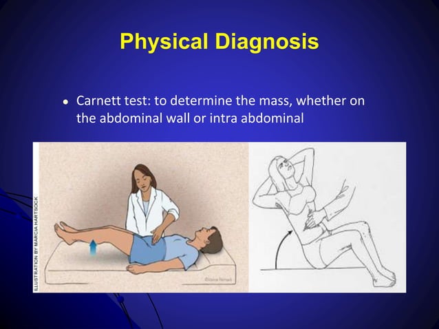 Abdominal mass .pptx