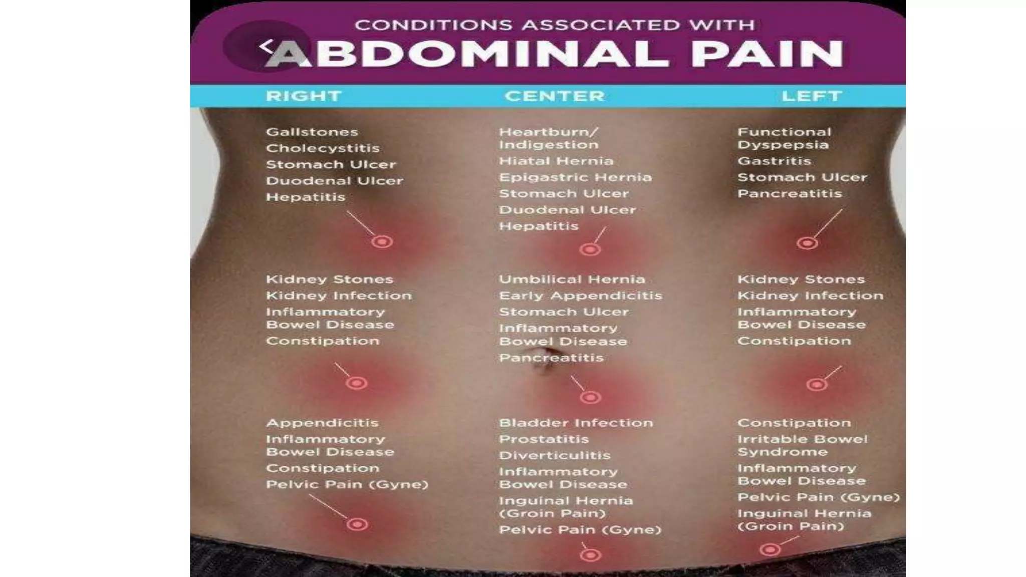 Abdominal pain - a brief study | PPTX