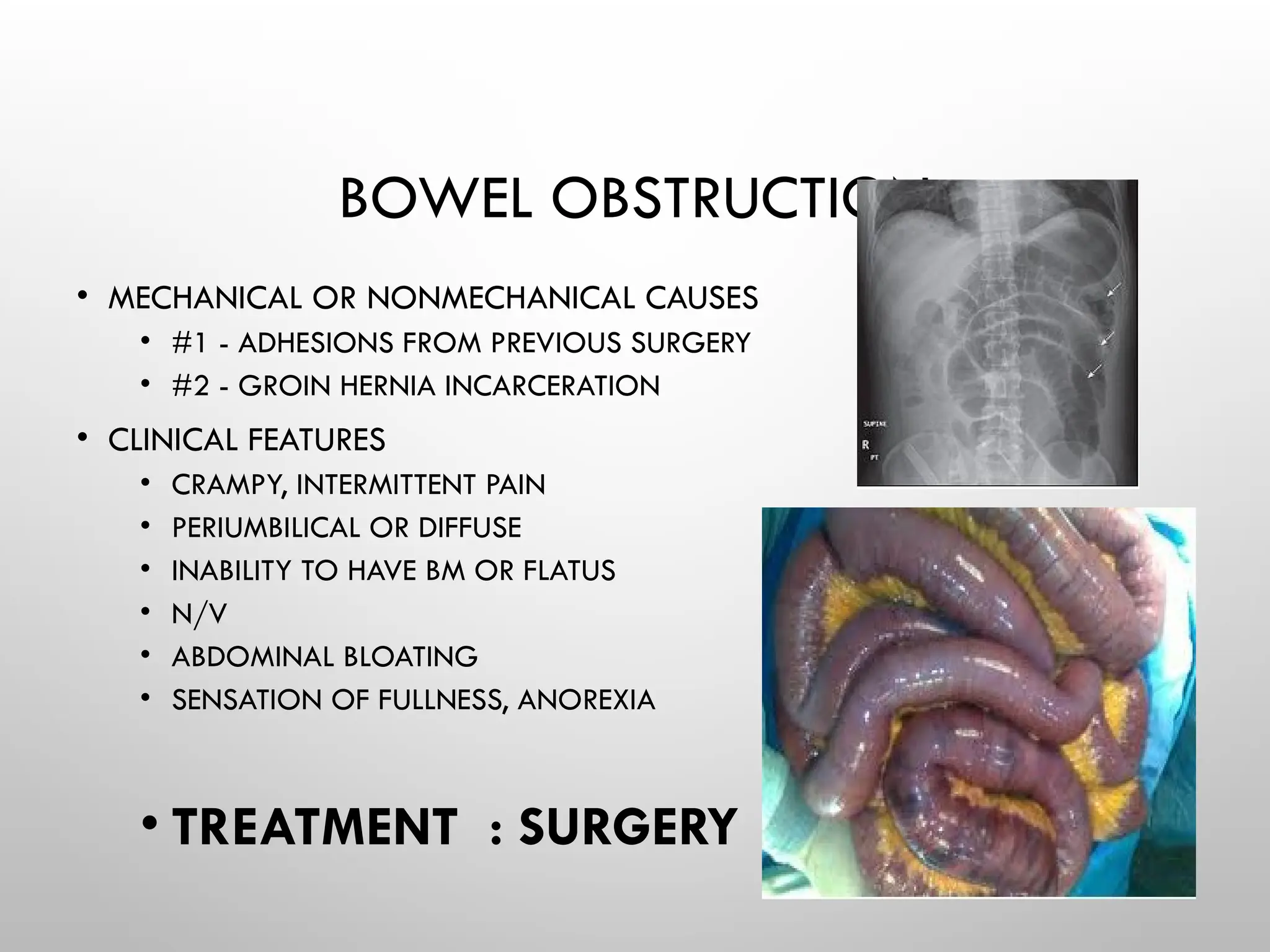 Abdominal pain - Dr Ramachandra - May 2024.pptx