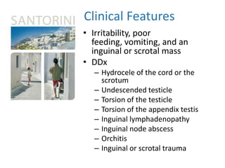 Abdominal pain in children | PPTX