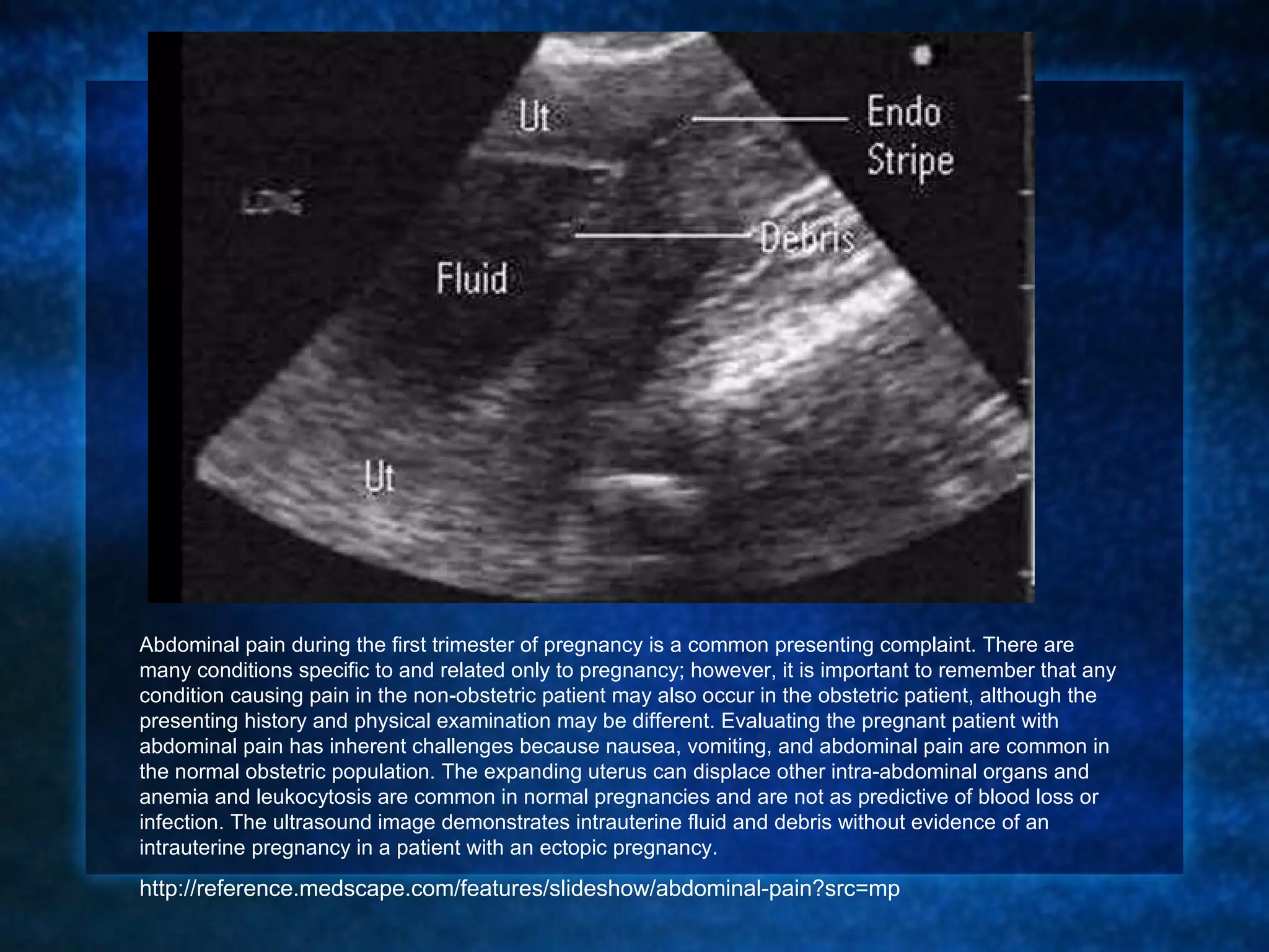 Abdominal pain in pregnancy | PPT