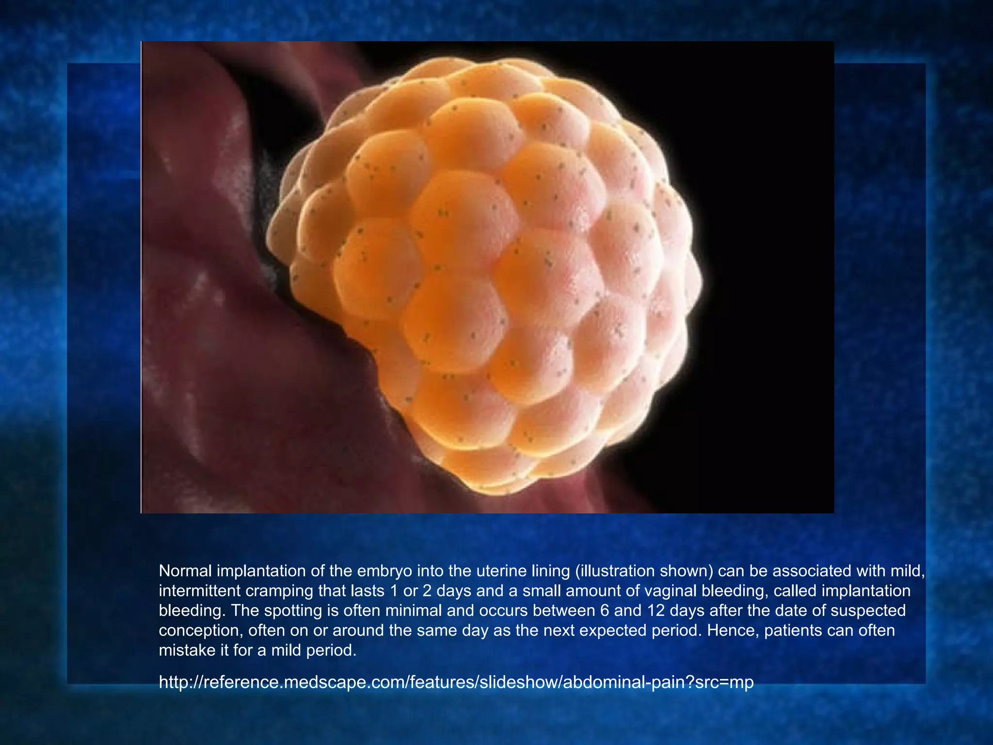 Abdominal pain in pregnancy | PPT