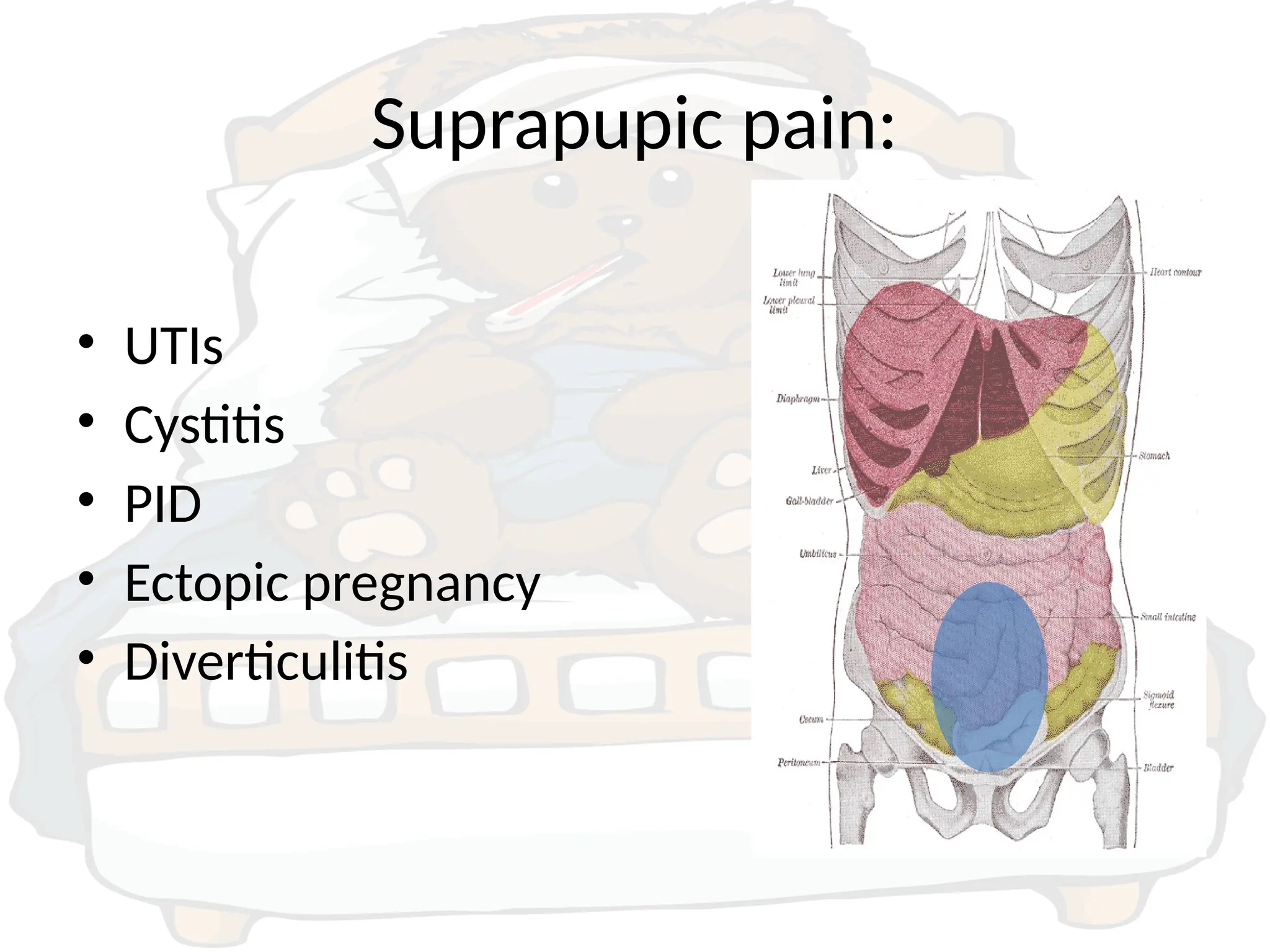 Approach to abdominal pain in children.pptx