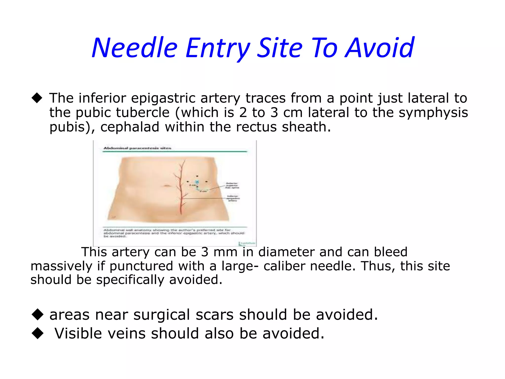 Abdominal paracentesis | PPTX