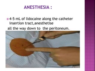 Abdominal paracentesis | PPTX