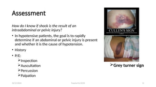 abdominal pelvic trauma and its emergency managment.pptx
