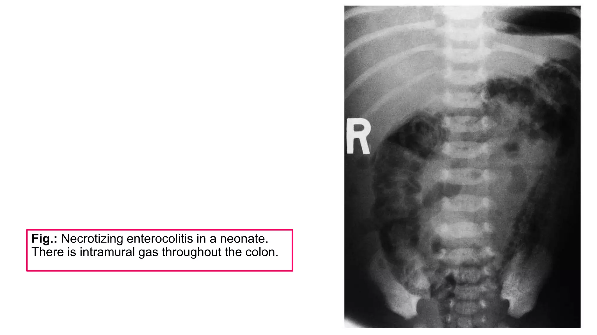 Abdominal Plain.pptx