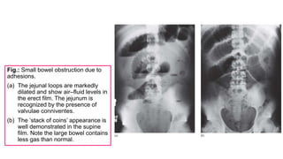Abdominal Plain.pptx