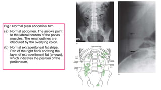 Abdominal Plain.pptx