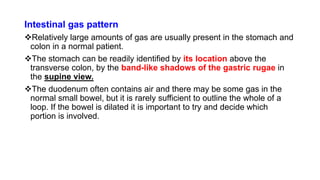 Abdominal Plain.pptx