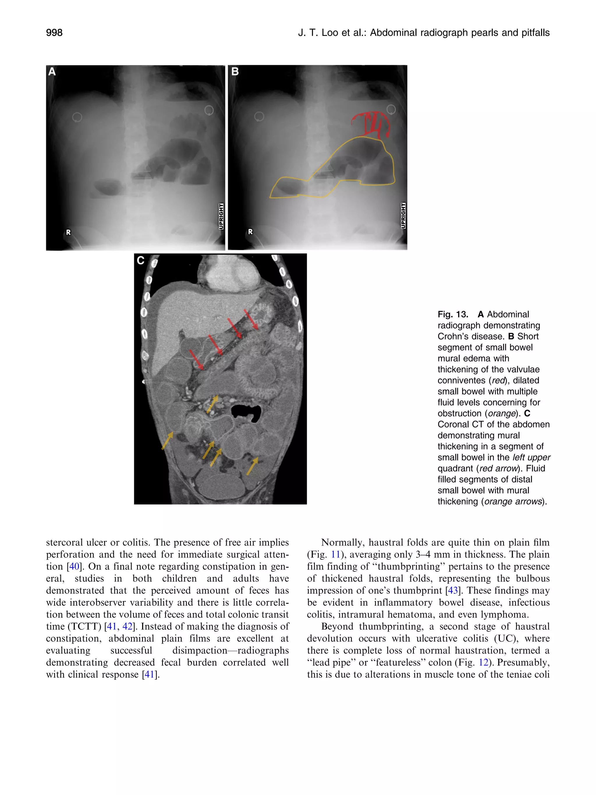 Abdominal radiograph | PDF