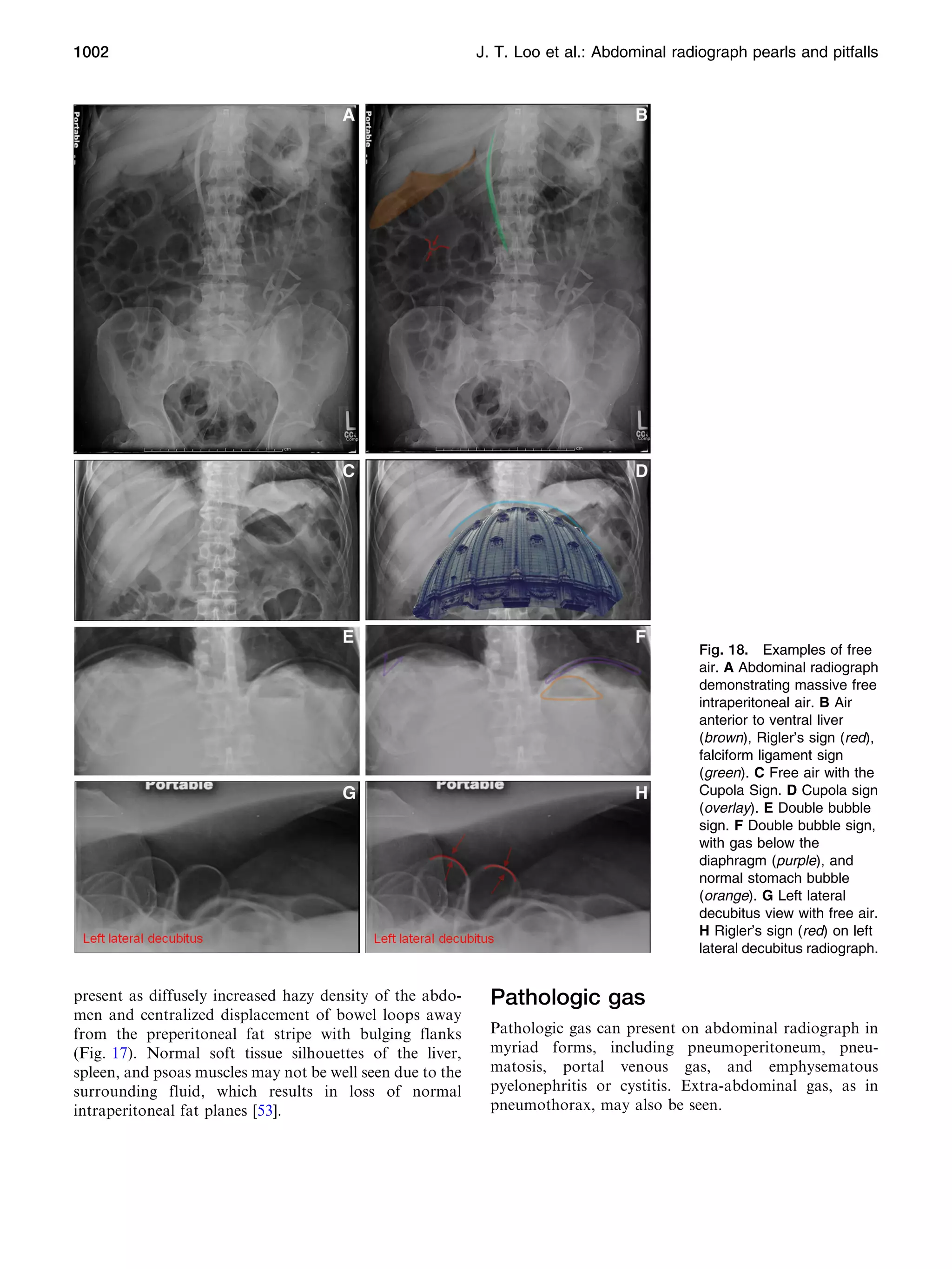 Abdominal radiograph | PDF