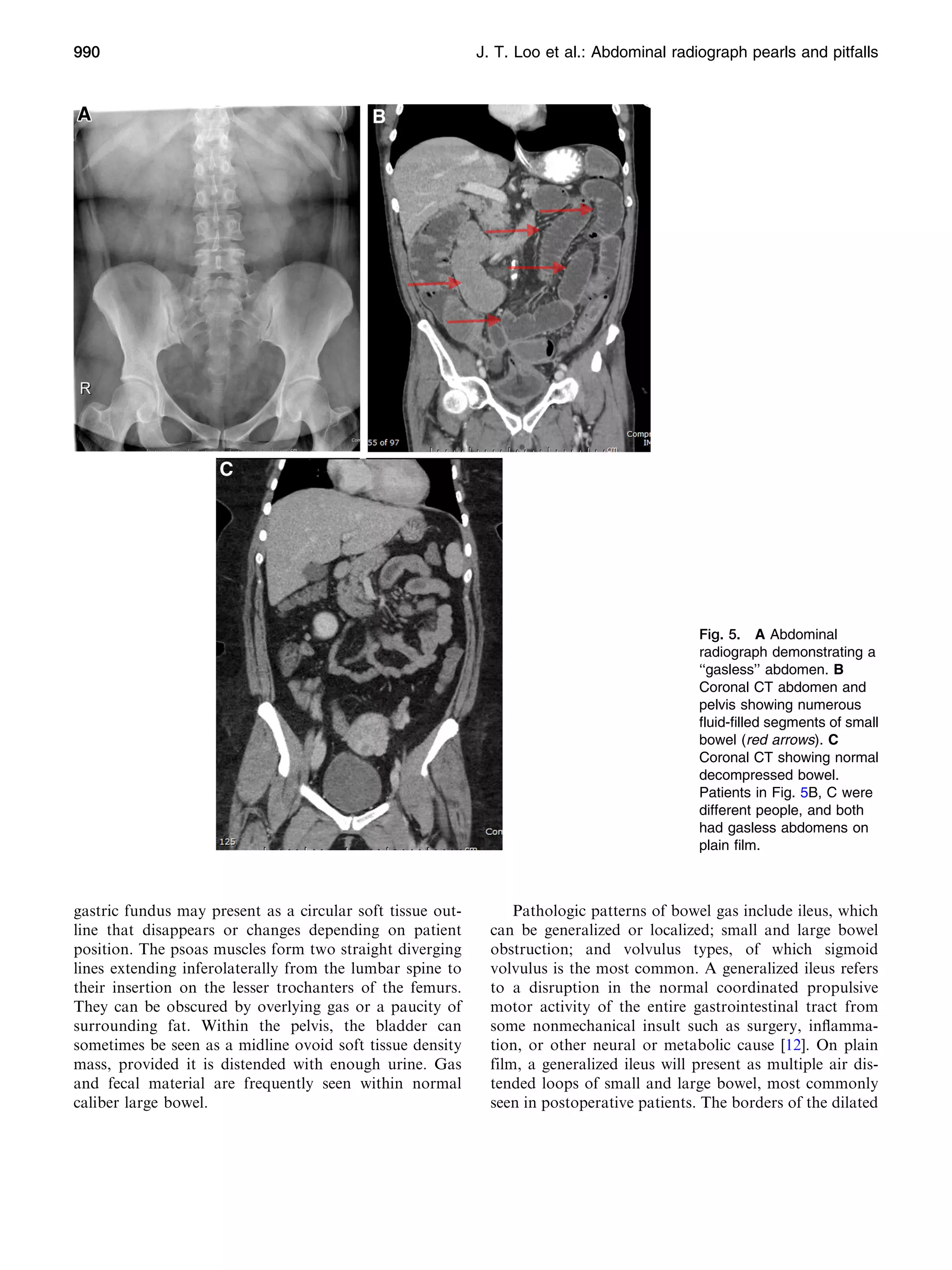 Abdominal radiograph | PDF